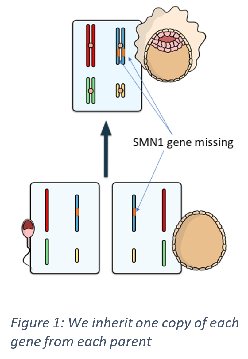 Disease Modifying Treatments | AUSNMD